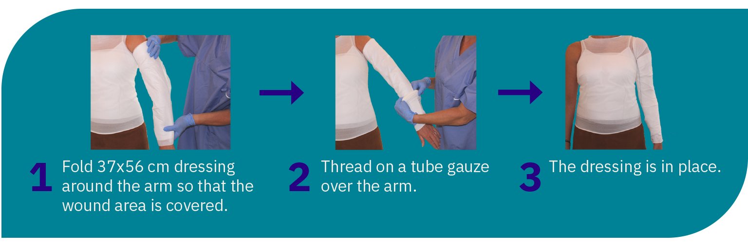 A folding guide for wound dressings | Wound management